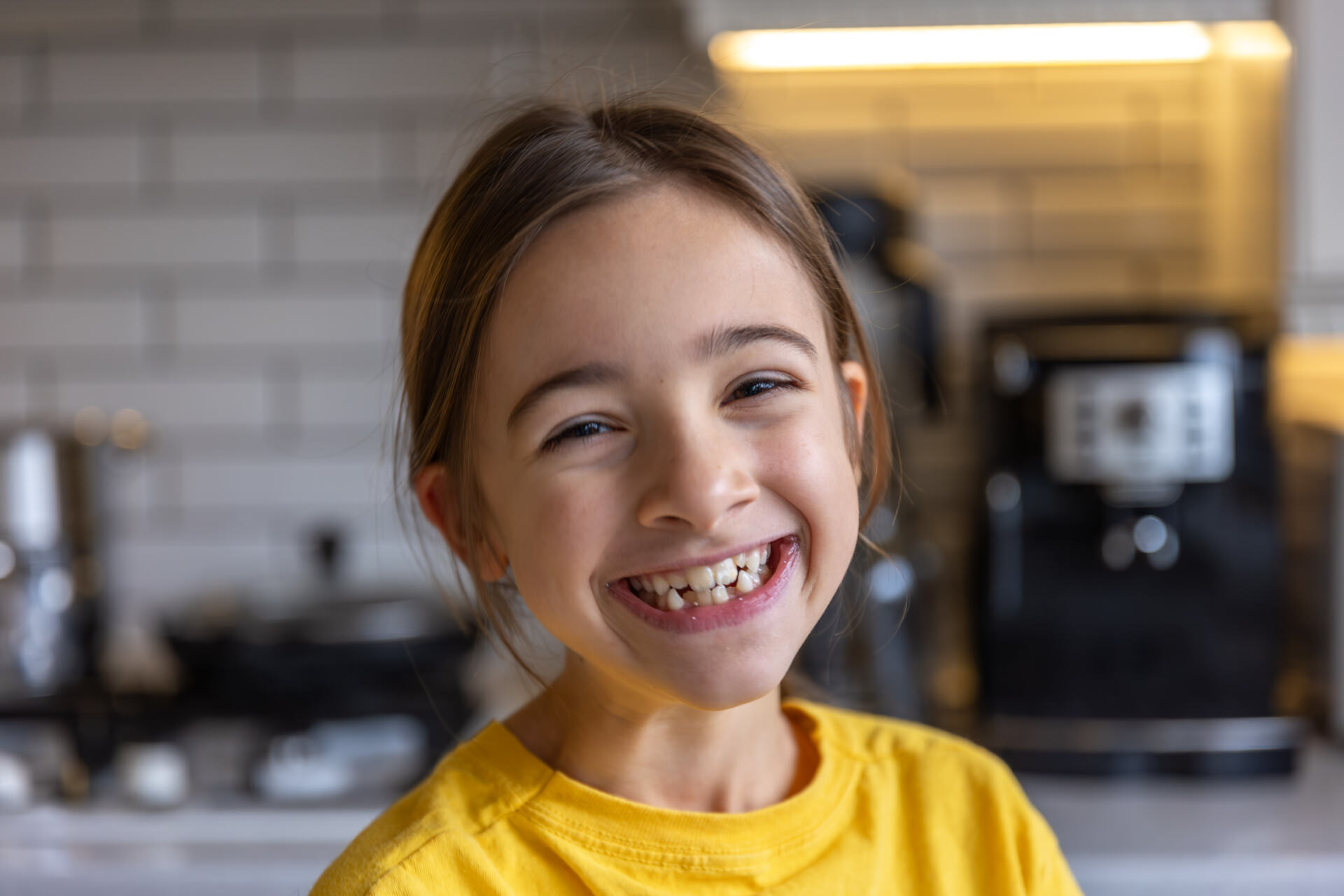 A tejfogak szerepe – miért fontos az ápolásuk, ha úgyis kiesnek ...